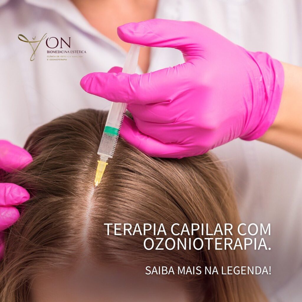 TERAPIA CAPILAR COM OZONIOTERAPIA - @onsaudeintegrativa
